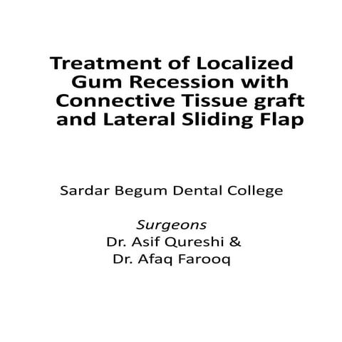 Perio surgery | PPTX