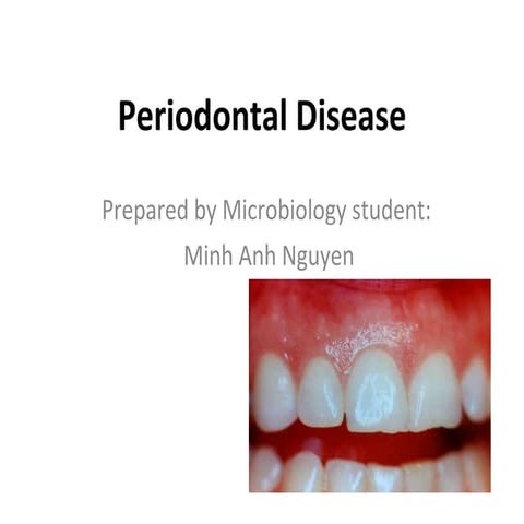 Periodontal disease | PPT