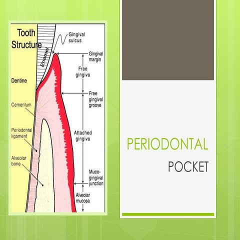 Periodontal pocket copy.pptx perio mds ppt | PPTX