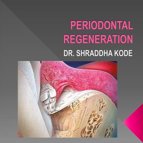 Periodontal regeneration | PPTX