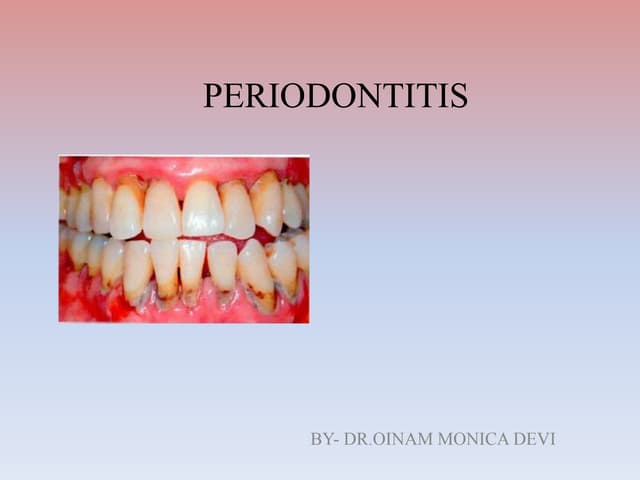 2017 classification of periodontal and periimplant diseases | PPTX