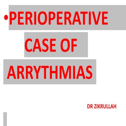 Perioperative case of arrhythmias | PPTX