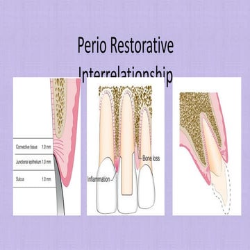 Perio restorative inter relationship lecture.pdf