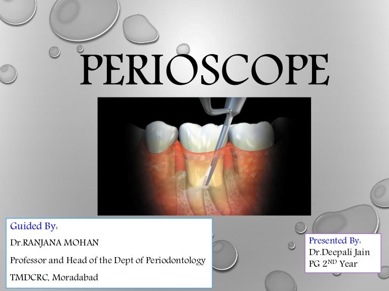 Perioscope