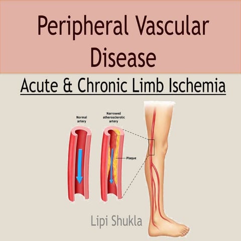 Peripheral-Vascular-Disease-Surgical-Presentation.ppt