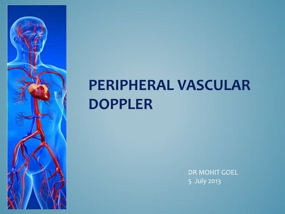 Doppler ultrasound in peripheral arterial disease | PPT