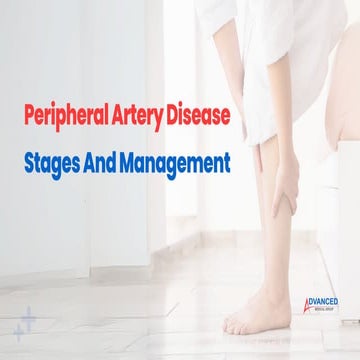 Peripheral Artery Disease Stages And Management.pdf