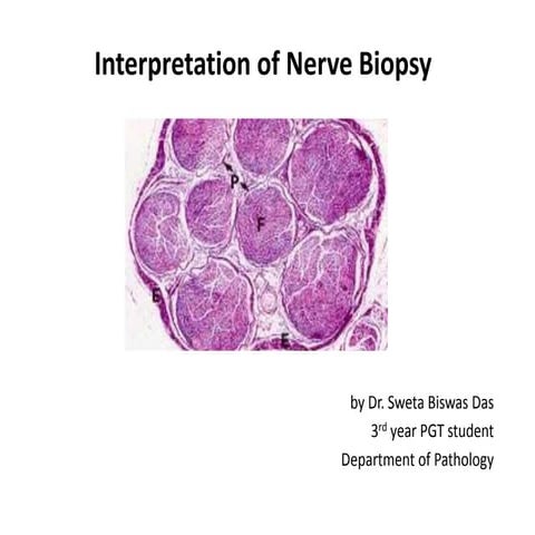 Peripheral nerve biopsy | PPTX
