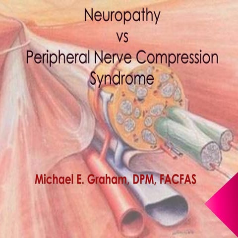 Peripheral Nerve Compression Syndrome | PPTX