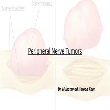 Peripheral Nerve Tumors (1).pptx ROBBIN PATHOLOGY | PPTX