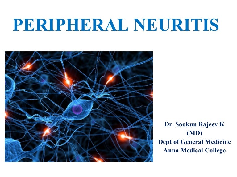 Peripheral Neuritis by Dr. Sookun Rajeev Kumar