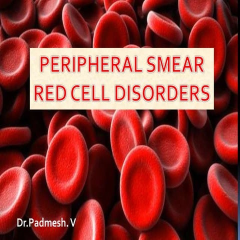 Peripheral smear..RBC disorders.. Dr.Padmesh | PPTX