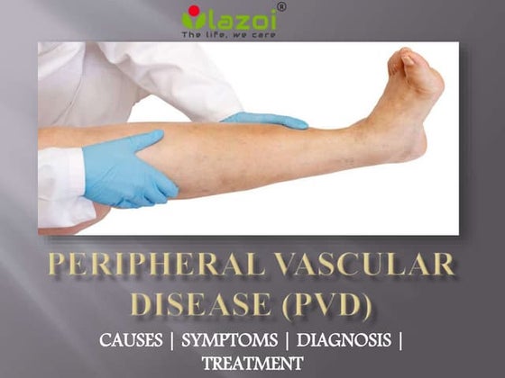 What Is Peripheral Vascular Disease? | PPT