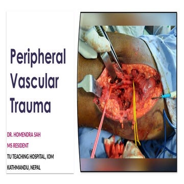 Vascular Trauma (peripheral) and it's Management.pptx