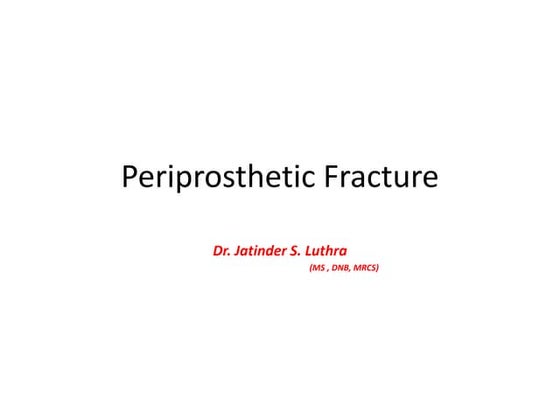 Femoral notching in total knee arthroplasty | PPT