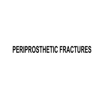 Peri prosthetic fractures.pptx.......... | PPTX