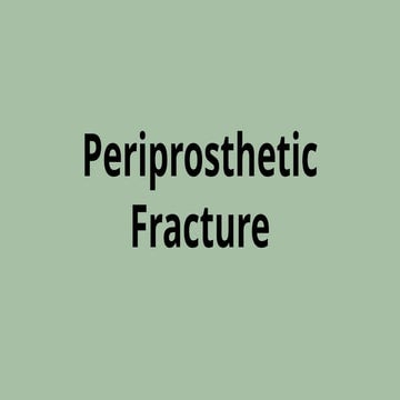Periprosthetic fractures (PF) are considered fractures associated with ...