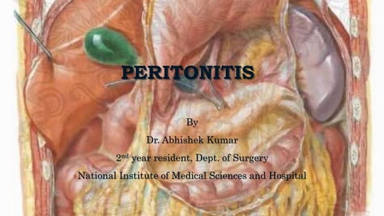 Peritonitis | PPT