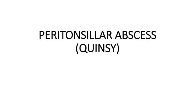 QUINSY (Peritonsillar Abscess) | PPT