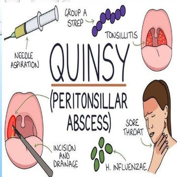 Comprehensive Overview of Peritonsillar Abscess (Quinsy): Anatomy ...