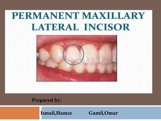 Maxillary central incisor (ORAL ANATOMY) | PPT