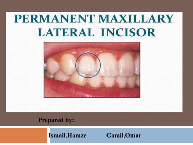 Permanent Maxillary Central Incisor | PPTX