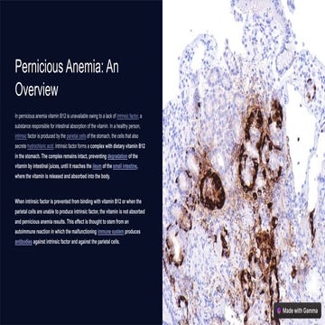 Pernicious-Anemia-An-Overview (1).pptx