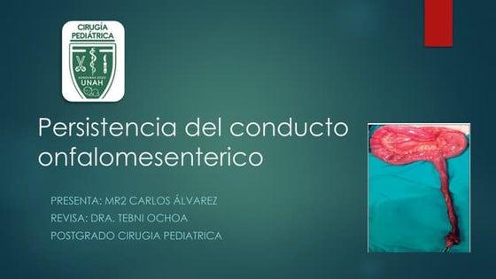 Diverticulo de meckel | PPT