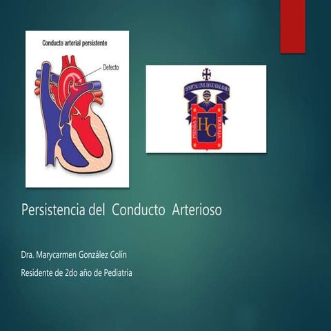 Persistencia del conducto arterioso | PPTX