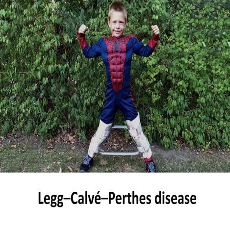 Classification perthes Disease | PDF