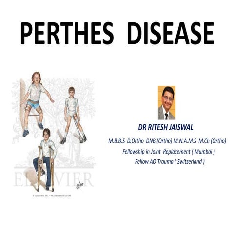 PERTHES DISEASE | PPTX