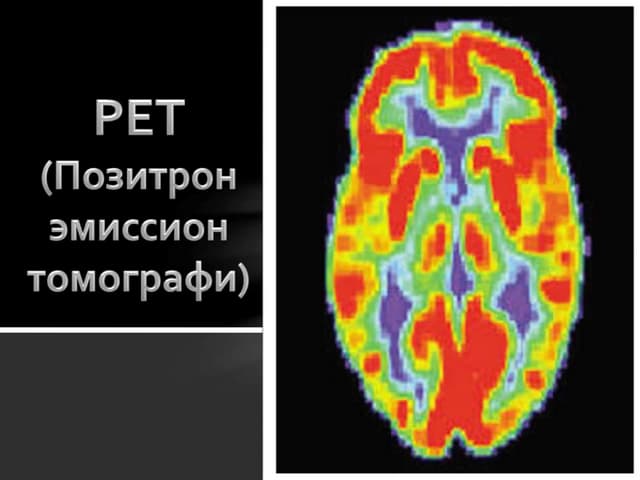 Positron Emissions Tomography (PET SCAN) | PPTX