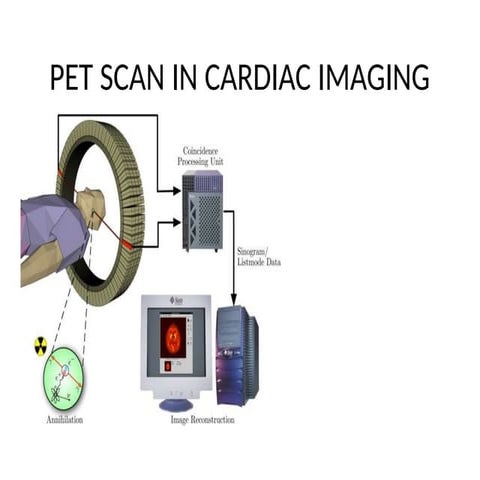 PET SCAN in the management of cardiovascular | PPTX