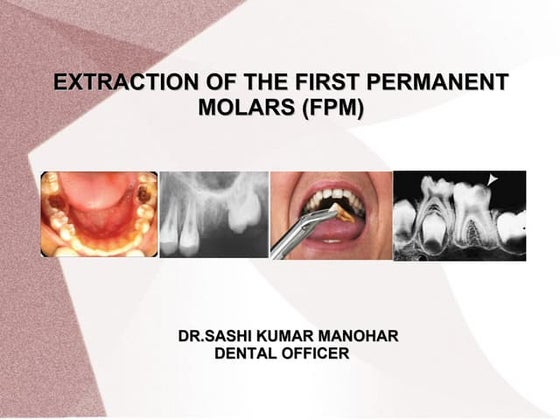Permanent mandibular first molar | PPT