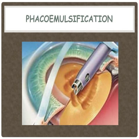 Phacoemulsification | PPT