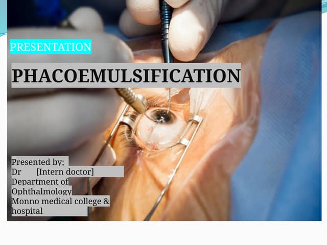 Phacoemulsification part 1 | PPTX
