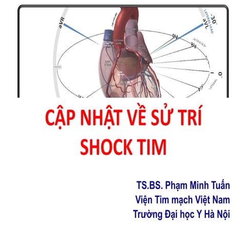 Shock Tim | PDF