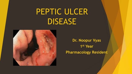 pathophysiology of peptic ulcers | PPT