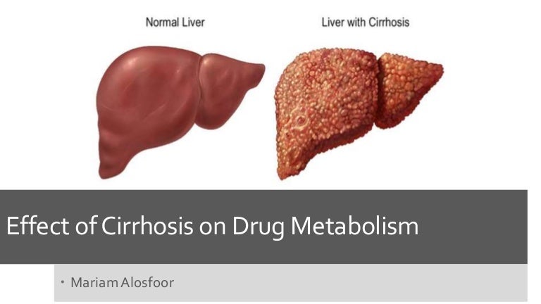 Effect of Liver Disease on Drug Metabolism