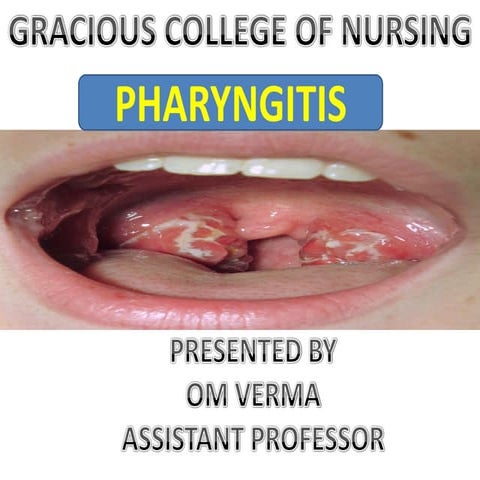 PHARYNGITIS AND ITS NURSING MANAGEMENT.pdf