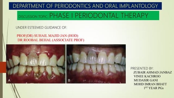 Phase 1 periodontal therapy | PPTX | Dental Health | Diseases and ...