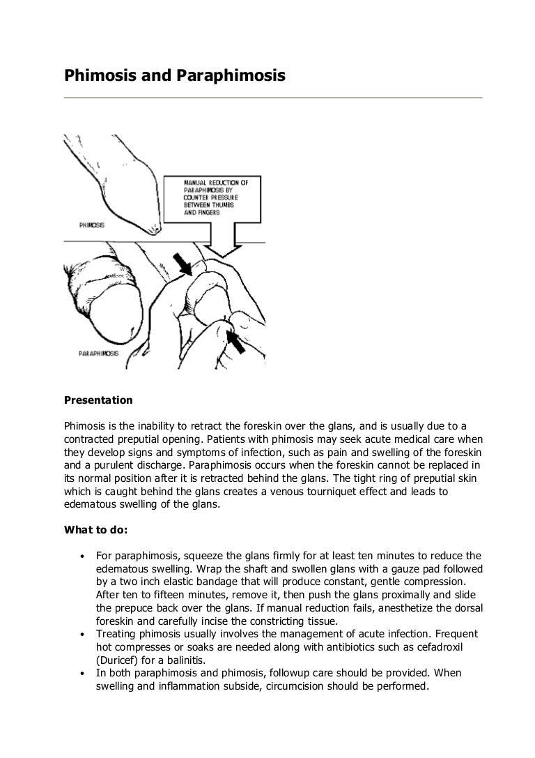 Phimosis And Paraphimosis
