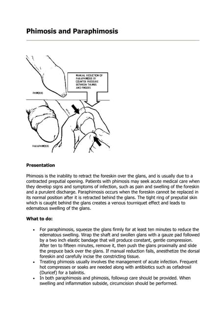 Paraphimosis in Cattle | PPT