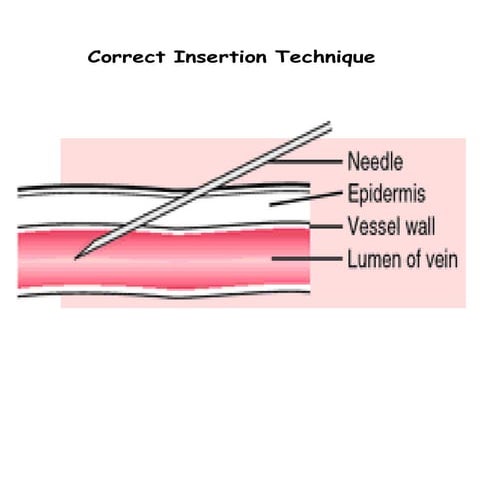 Phlebotomy Made Easy | PDF