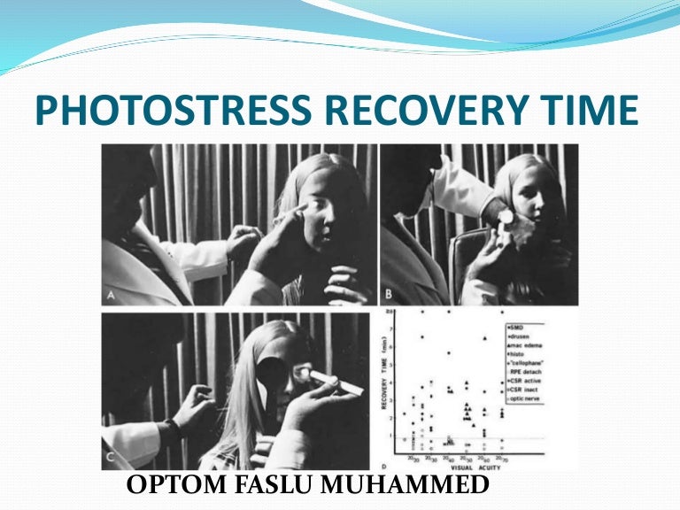 Photostress recovery time