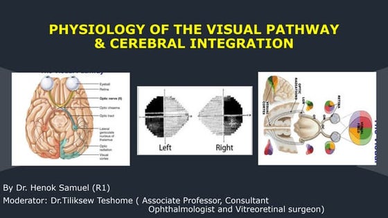 Lesions of the visual pathway | PPT