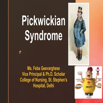 Pickwickian Syndrome Ppt