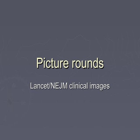 Picture rounds | PPT