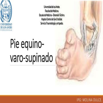 Pie equino-varo-supinado.pptx