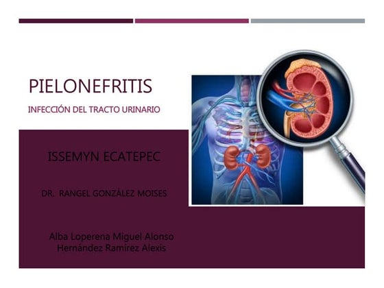 Pielonefritis Aguda En Adultos | PPT